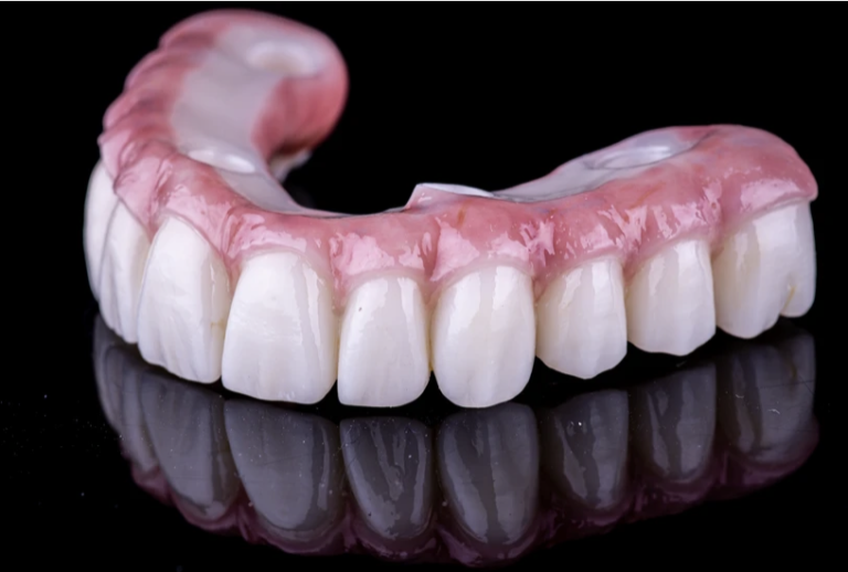 Fixed Zirconia Full Arch Teeth Express - Detail Dental